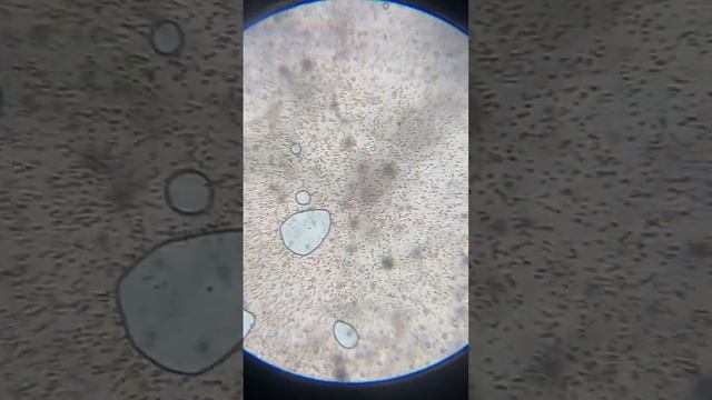 Кровь человека под микроскопом на малой кратности #телочеловека#мирподмикроскопом#подмикро