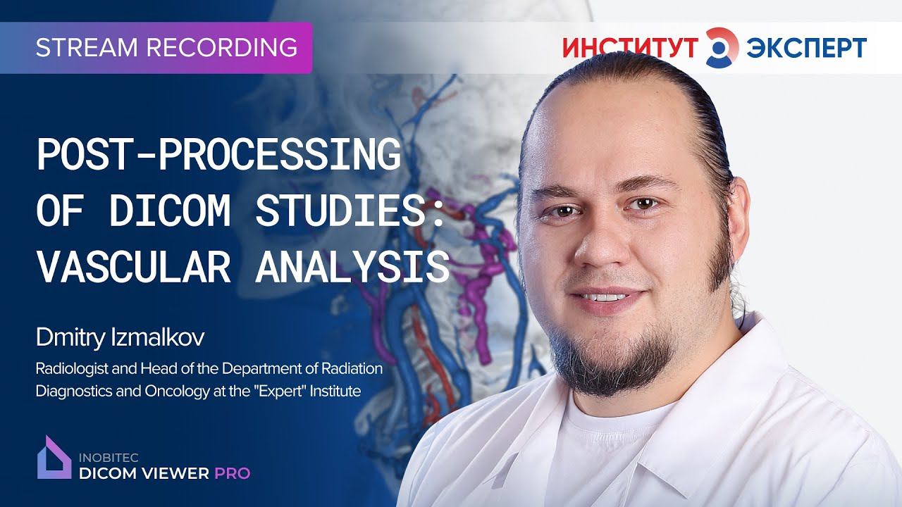 Постобработка DICOM-исследований: анализ сосудов