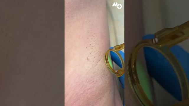 Идеальная гладкость подмышек — это реально??