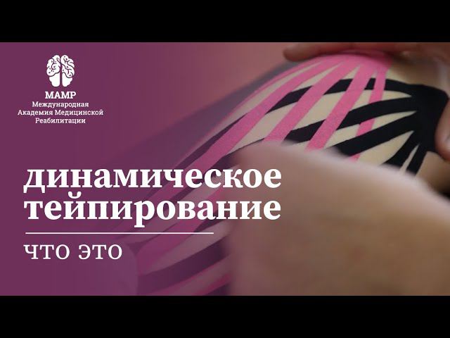 Что такое динамическое тейпирование | Кинейзиотейпинг | МАМР