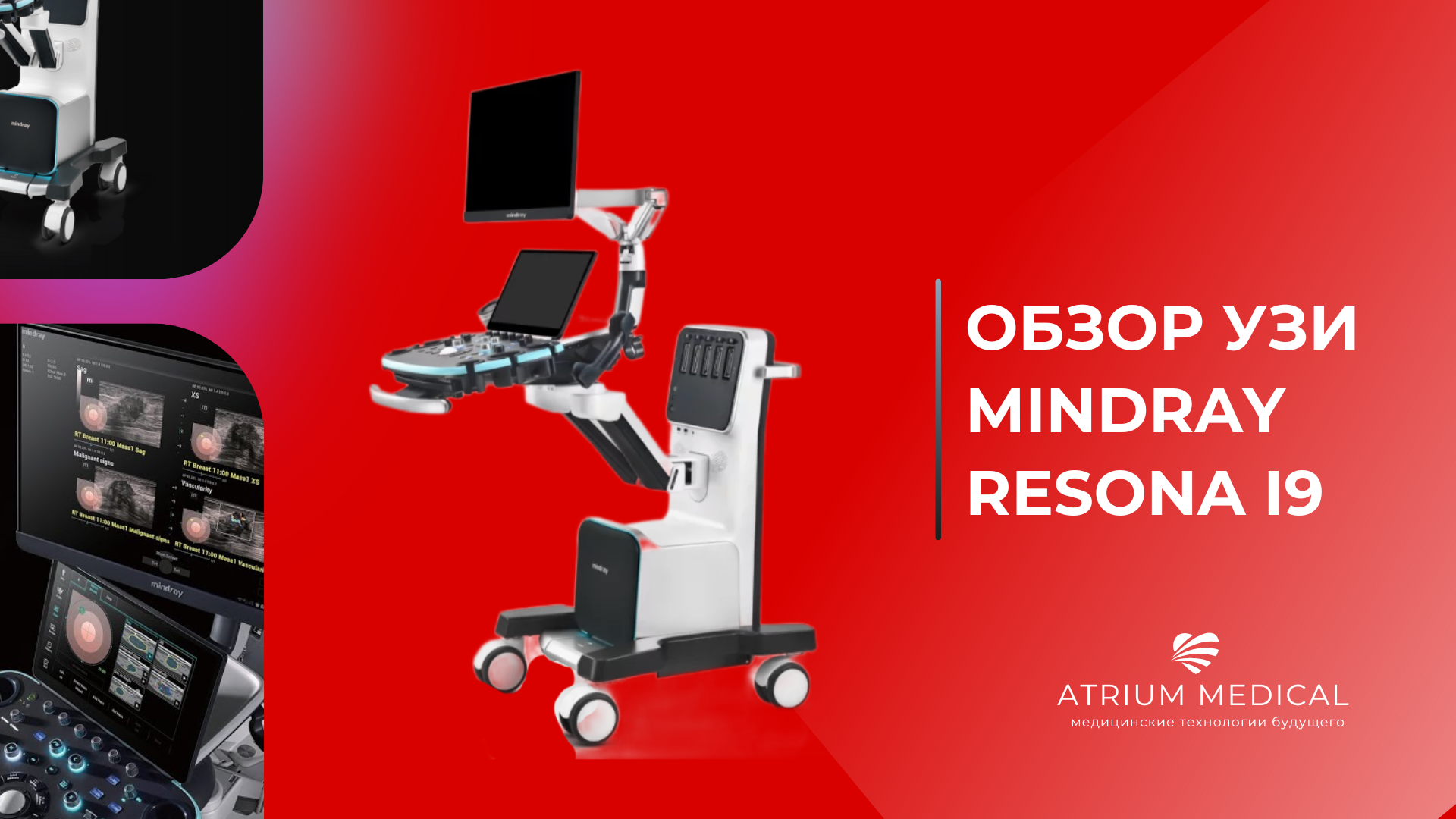 Обзор УЗИ для общей визуализации Mindray Resona i9