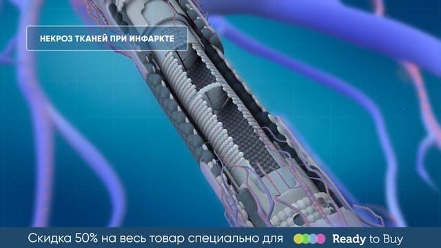 Изделие с микросферами "Анти варикозный бандаж Varifort" на торговой площадке Ready to Buy