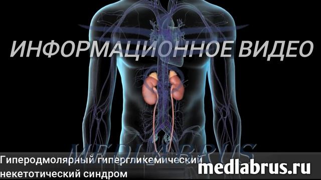 Все о диабете 2-го типа