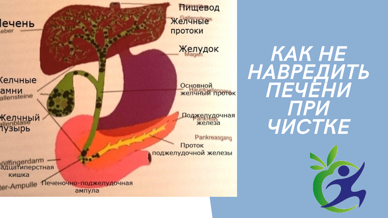 Камни в печени