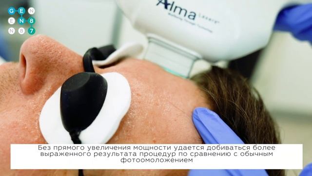 ФОТООМОЛОЖЕНИЕ HARMONY XL МУЖСКАЯ КОСМЕТОЛОГИЯ Сеть клиник косметологии GEN87