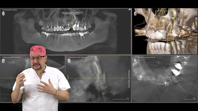 «Выбор стратегии» при удалении зуба в эстетически значимой зоне.