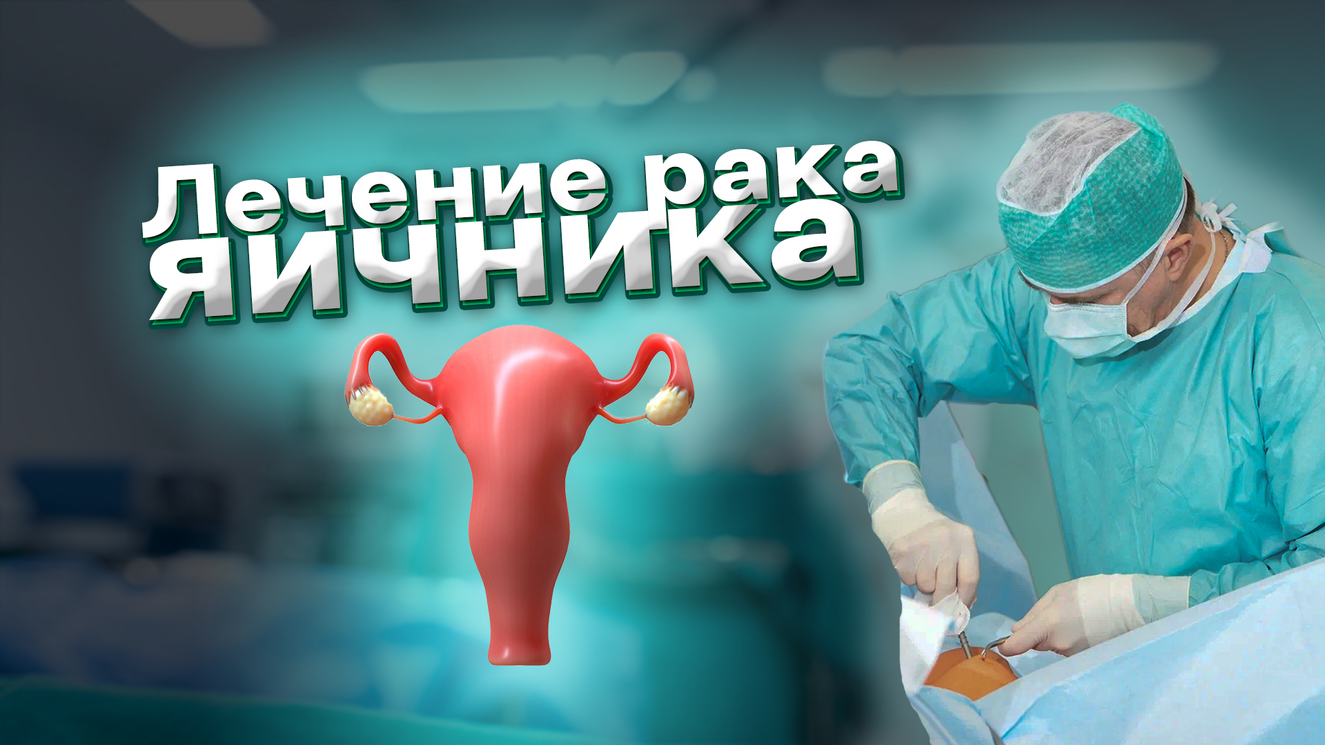 Метастаз Крукенберга. Онкогинекология