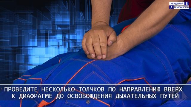 Освобождение дыхательных путей. Проведение приема Геймлиха пострадавшему, находящемуся без сознания