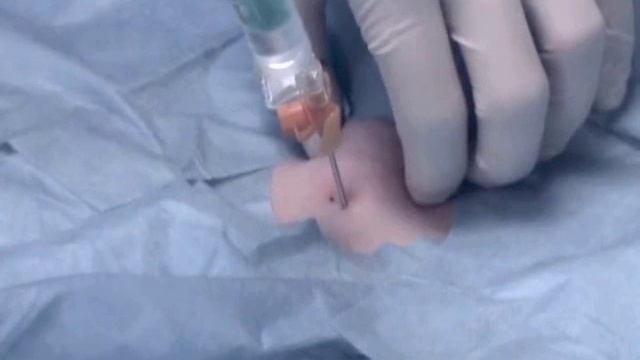 Трахеостомия_msn2 Горячев А.С. (3)