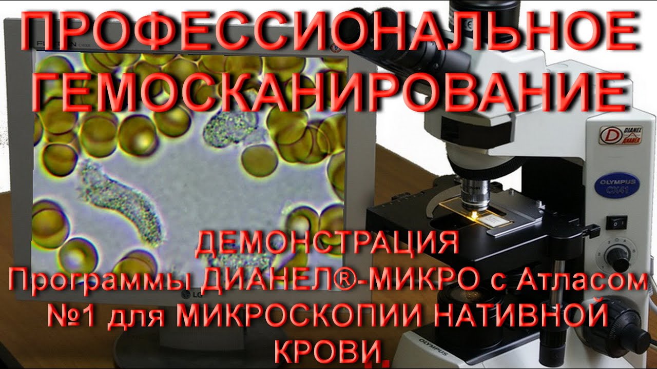 Дианел®-Микро No1 Гемосканирование, Микроскопия Нативной Крови программа для цифровых микроскопов