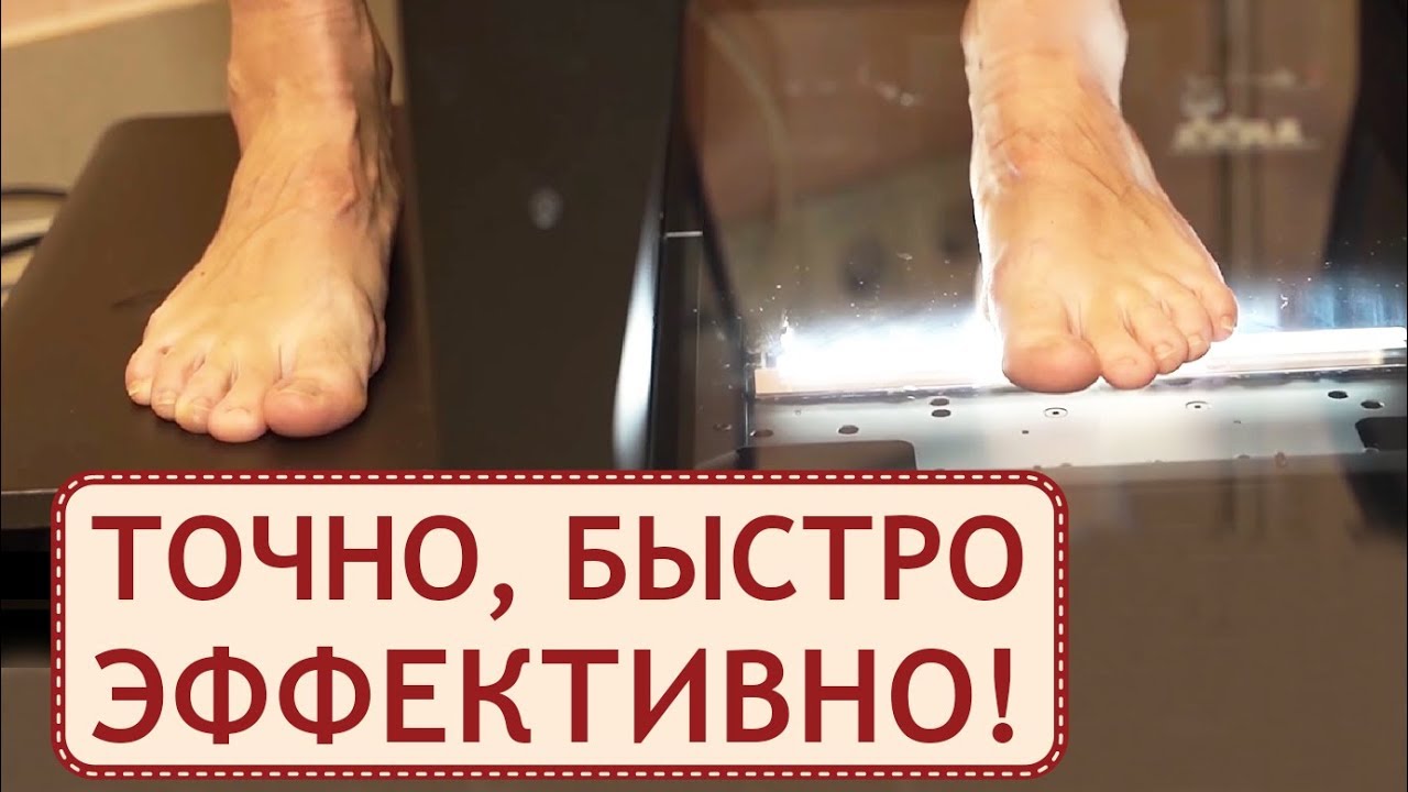 3D технологии в производстве идеальной ортопедической обуви. Сканирование стопы. 12+.mp4