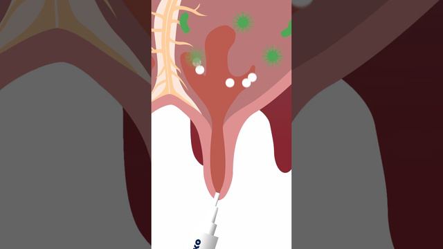 Лактико: эффективное лечение мастита у коров