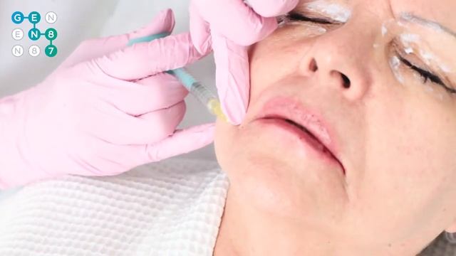 ОМОЛОЖЕНИЕ ЛИЦА ФИЛЛЕРАМИ Сеть клиник косметологии GEN87