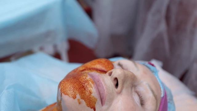 Постановка нитей.