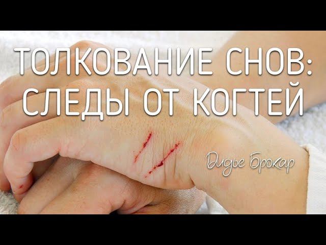 ТОЛКОВАНИЕ СНОВ. Следы от когтей. Дидье Брокар