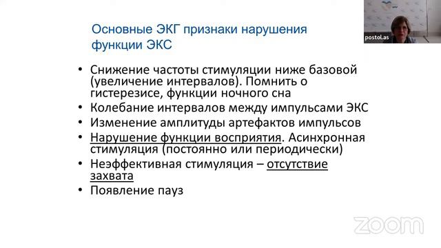 Основы сердечной ресинхронизирующей терапии. ЭКГ картина различных режимов работы...