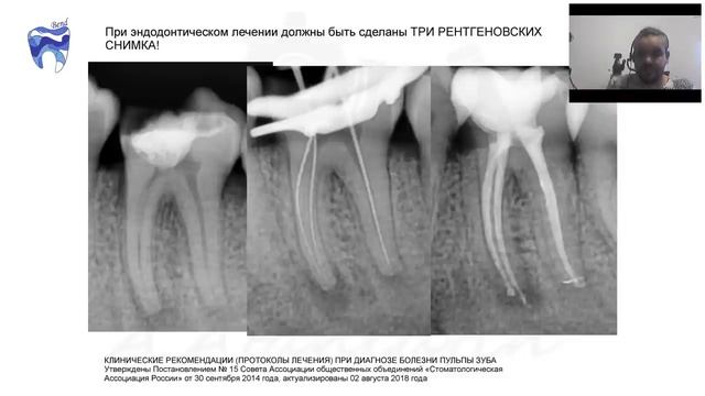 Вебинар №2 благотворительный. Основы рентгенодиагностики для эдодонтиста