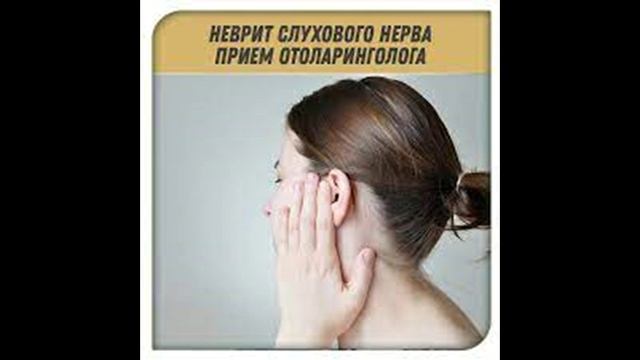 Неврит слухового нерва