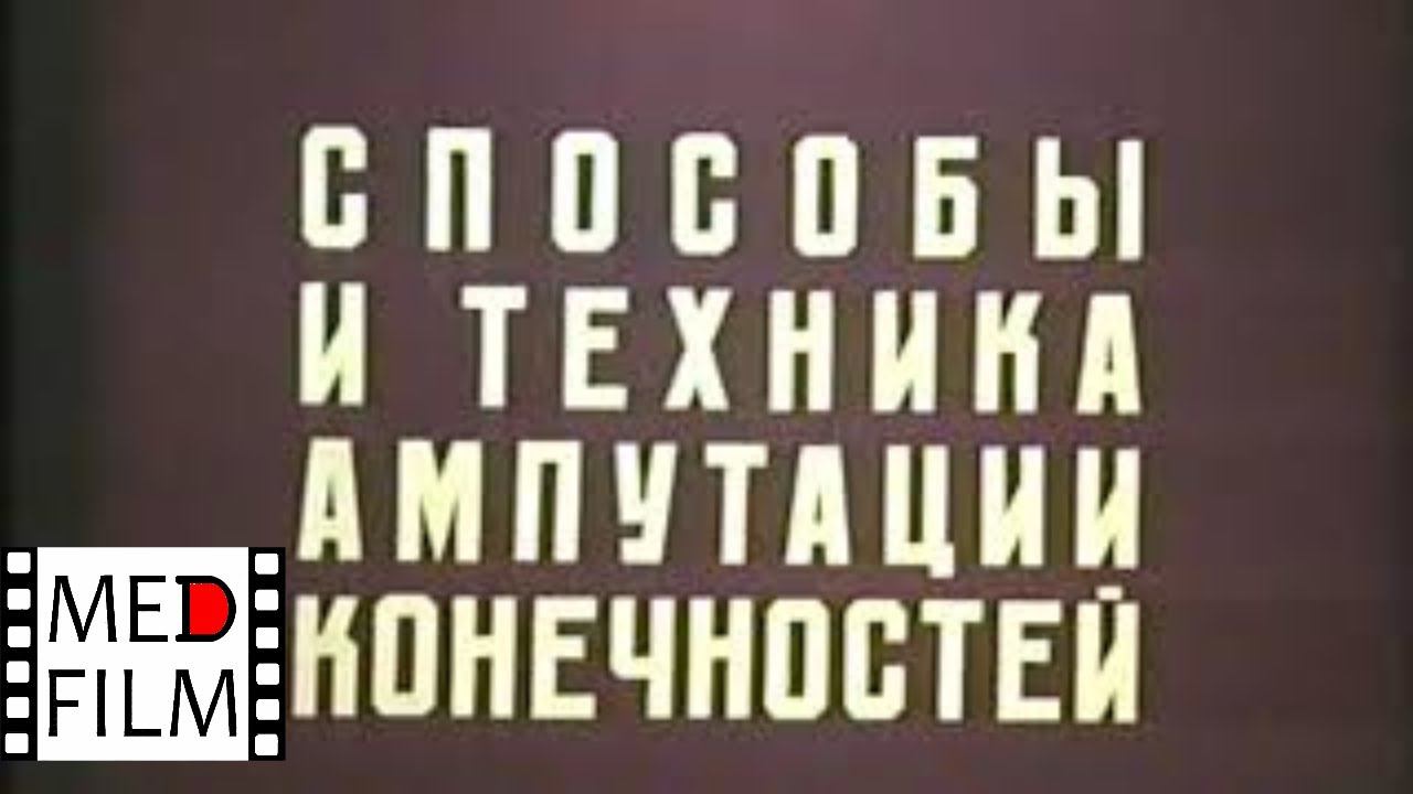 Ампутация конечностей (способы и техника). Академик В.В.Кованов © Amputation of the extremities