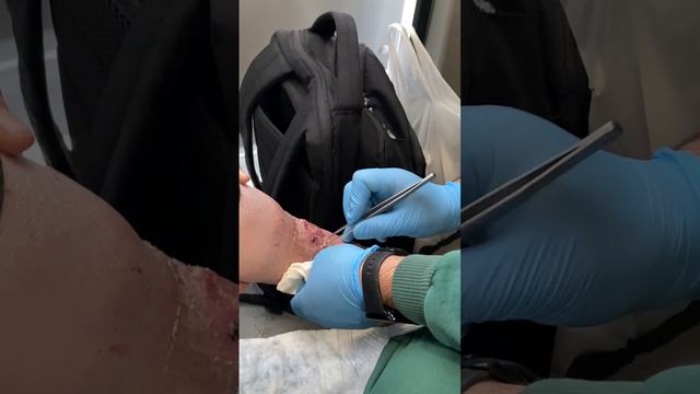 Перевязка улица зимой 18.01.2024 г.