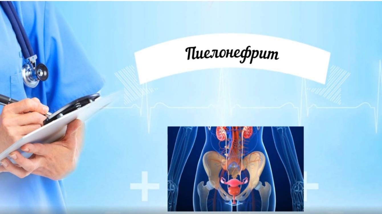 Пиелонефрит (МПС, часть 3)