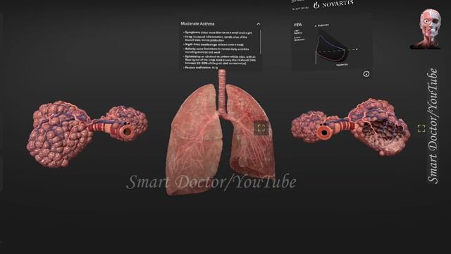 What happens to the lungs of asthmatics You can't imagine what's going on ! ??.mp4