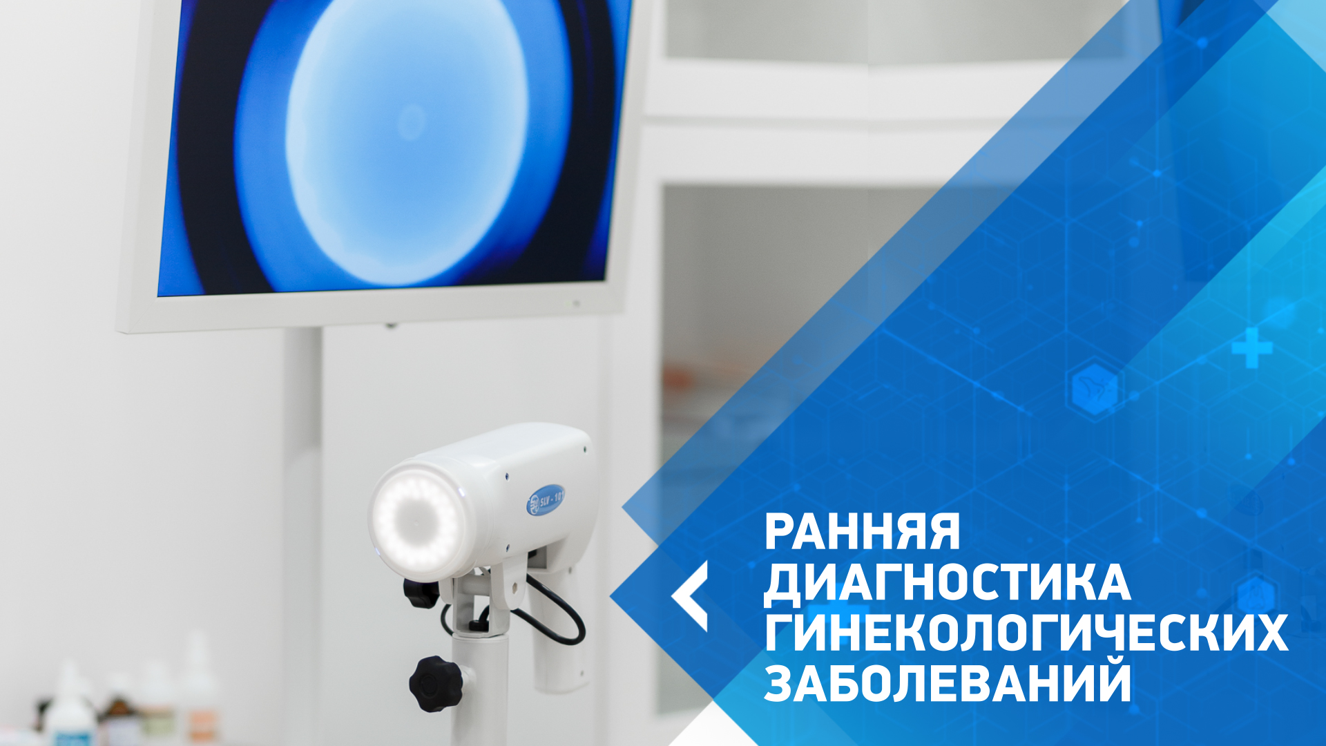 Ранняя диагностика гинекологических заболеваний