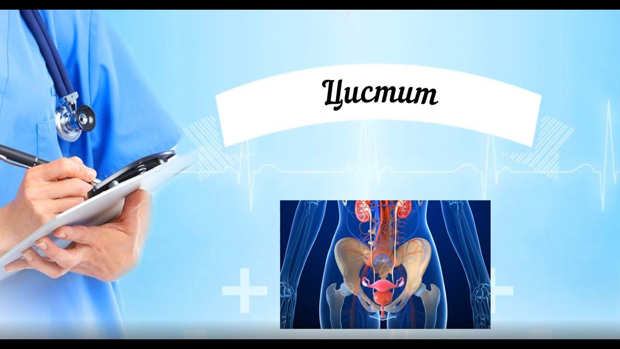 Цистит, (МПС, часть 4)