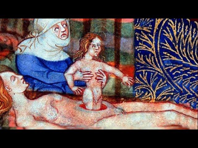 Первый период родов, обезболивание © The first period of labor, anesthesia