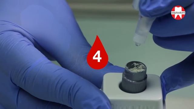 Смешивание Biodentine