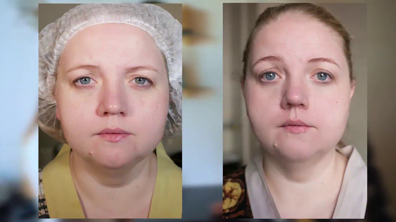 "Антипышка" 11 серия