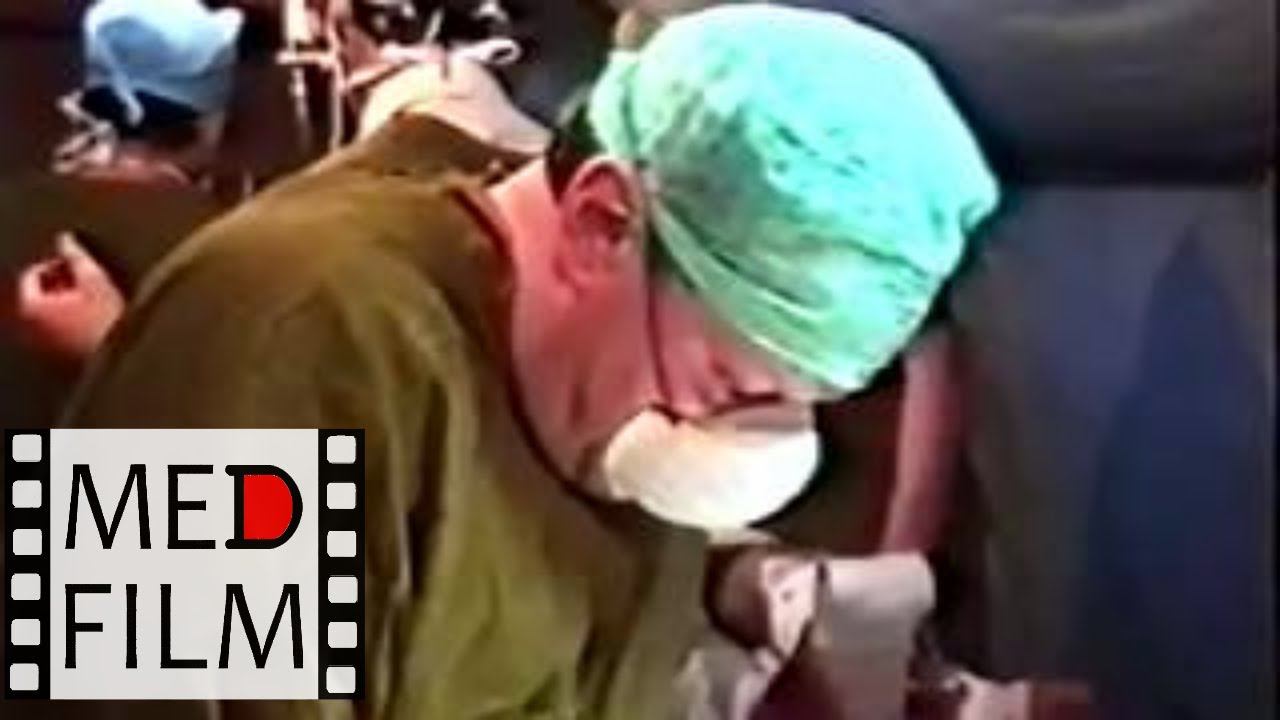 Удаление  осколка из ступни. Чечня-1995. Врачи ММА © Shell fragment from the foot. Chechnya-1995