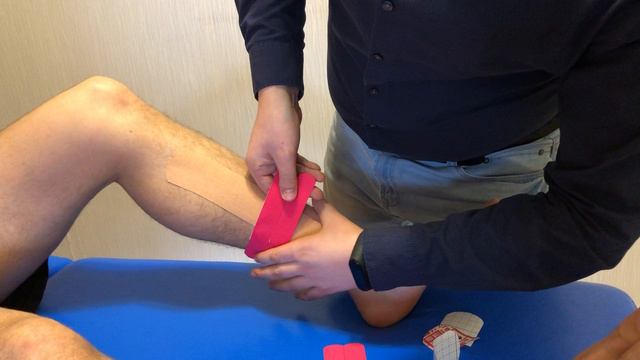 Наложение кинезио тейпа при воспалении надкостницы