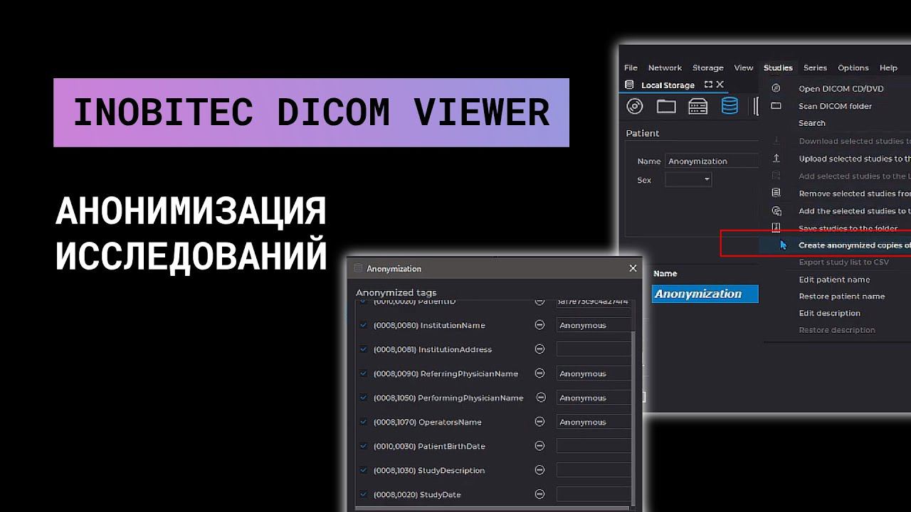 Анонимизация исследований в Инобитек DICOM-Просмотрщике