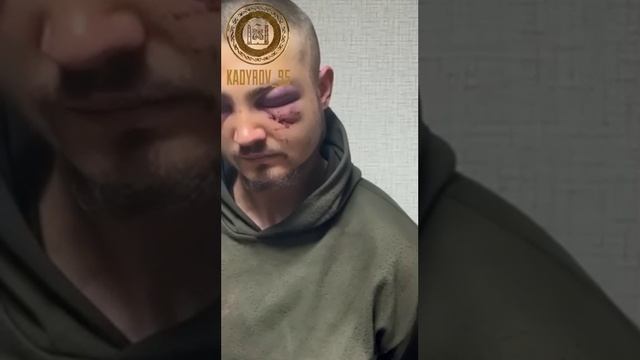 Чеченцы извиняются за первых пленных в Северодонецке.