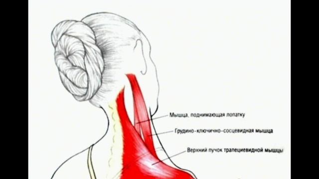 Синдром мышцы, поднимающей лопатку (познакомимся перед ее тренировкой). t.me/ChEl_sport
