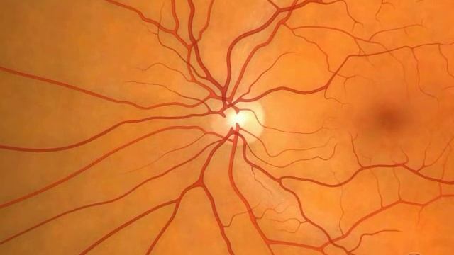 Анатомия глаза