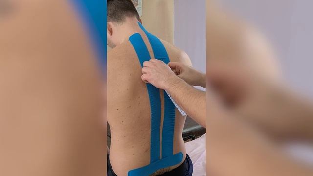 тейпирование шейно-воротниковой зоны.mp4