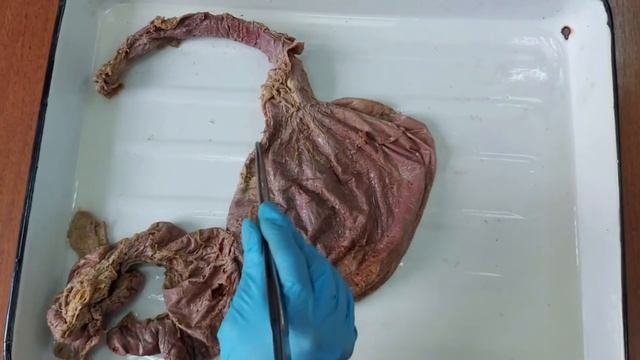 Глотка, пищевод, желудок