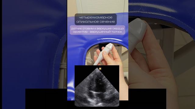 Тяжело выводить апикальные проекции в ЭХО собак и кошек? Это видео должно помочь