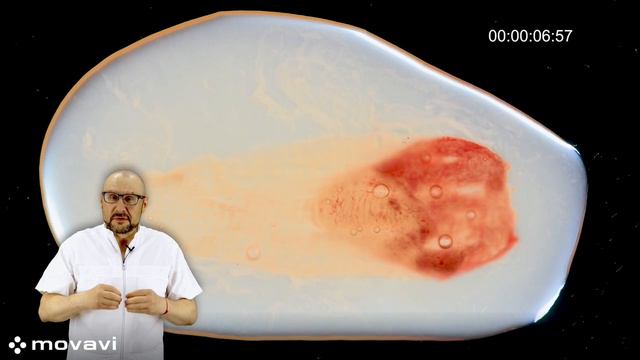 Магическая сила жидкого фибриногена в стоматологической практике.