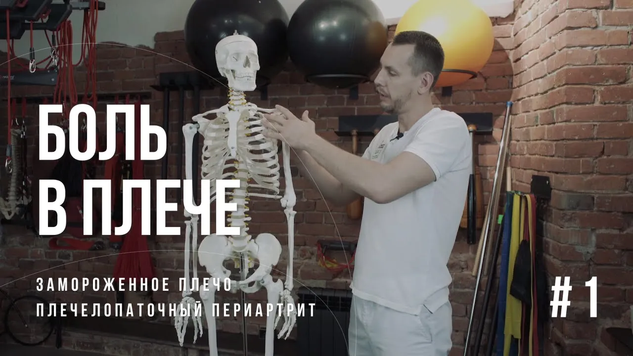 Замороженное плечо или плечелопаточный периартрит — Причины, диагностика и лечение