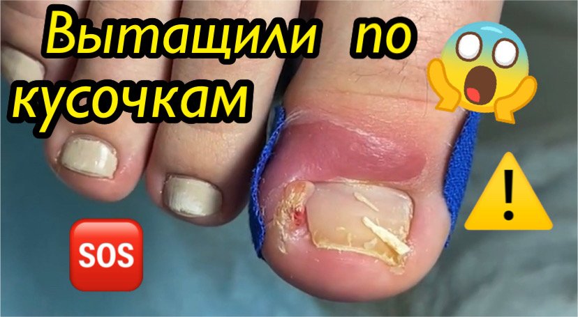 Вытащили по кусочкам?⚠️?❗️??