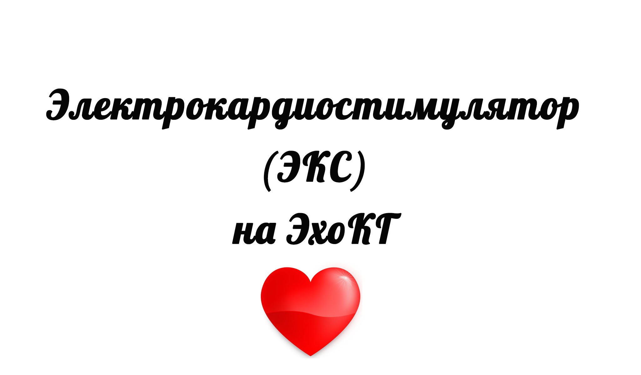 Электрокардиостимулятор (ЭКС) на узи сердца