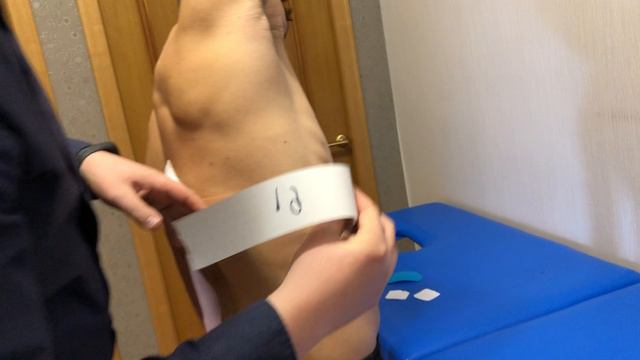 Наложение кинезио тейпа при переломе ребер.