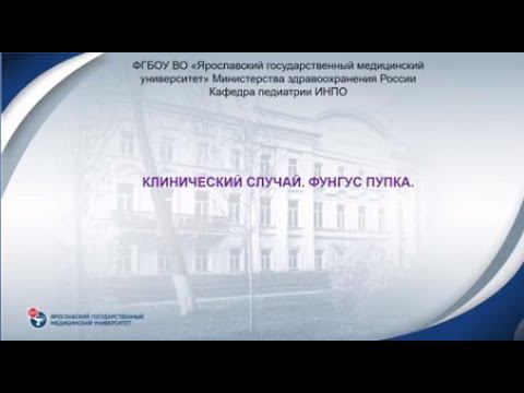Фунгус пупка:  ассистент кафедры Педиатрии ИНПО кандидат медицинских наук  Салова А.Л.