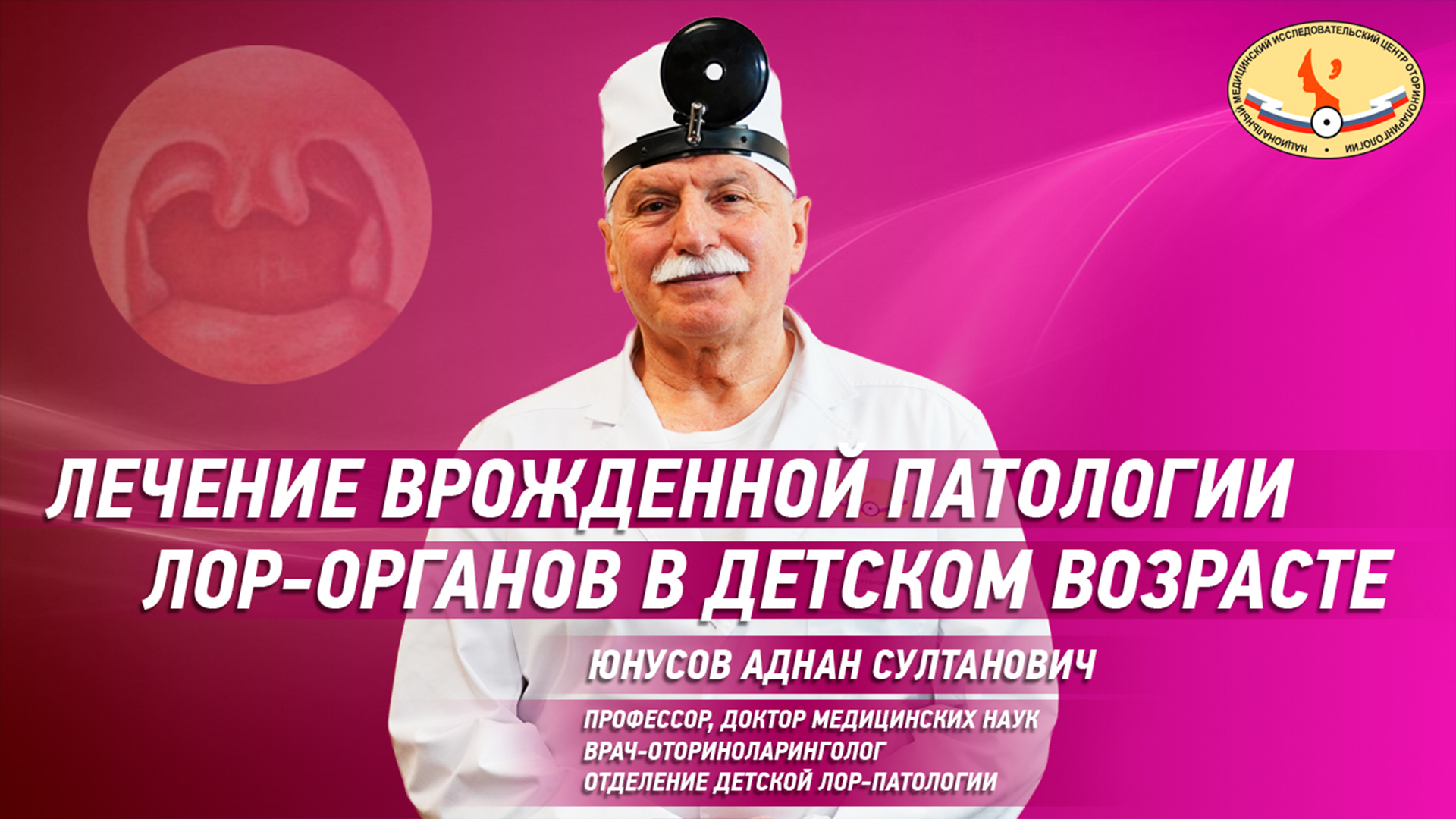 Лечение врожденной патологии ЛОР - органов в детском возрасте
