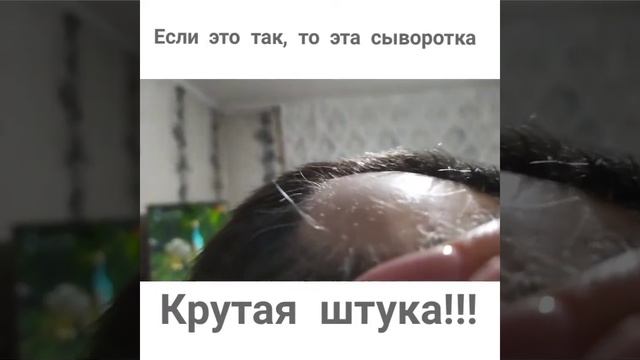 Алопеция у женщин. Сыворотка Occuba Active против Аллопеции. Часть 1.mp4