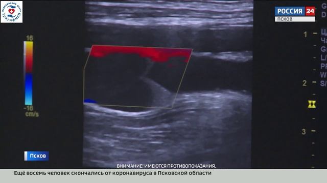 Вести 24 Псков о Медицинском центре ТриумфМЕД от 20.01.2022 #RAMstudio60