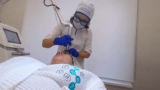 БЕЗОПЕРАЦИОННАЯ БЛЕФАРОПЛАСТИКА 360 АВТОРСКАЯ ПРОЦЕДУРА Сеть клиник косметологии GEN87